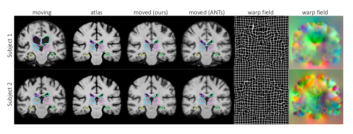 【学习笔记VoxelMorph系列文章2】：《Unsupervised Learning for Fast Probabilistic Diffeomorphic Registration ...