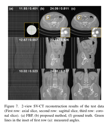 Solving 3D Inverse Problems using Pre-trained 2D Diffusion Models-CSDN博客