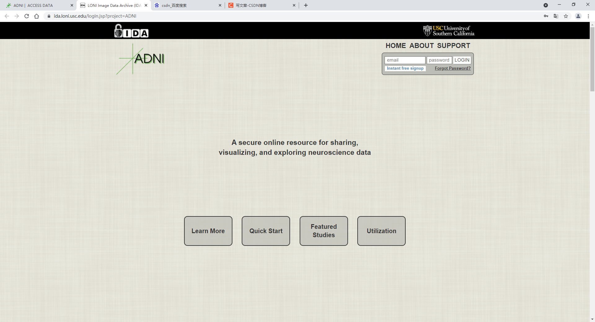 ADNI数据集下载方法（完全步骤）-CSDN博客