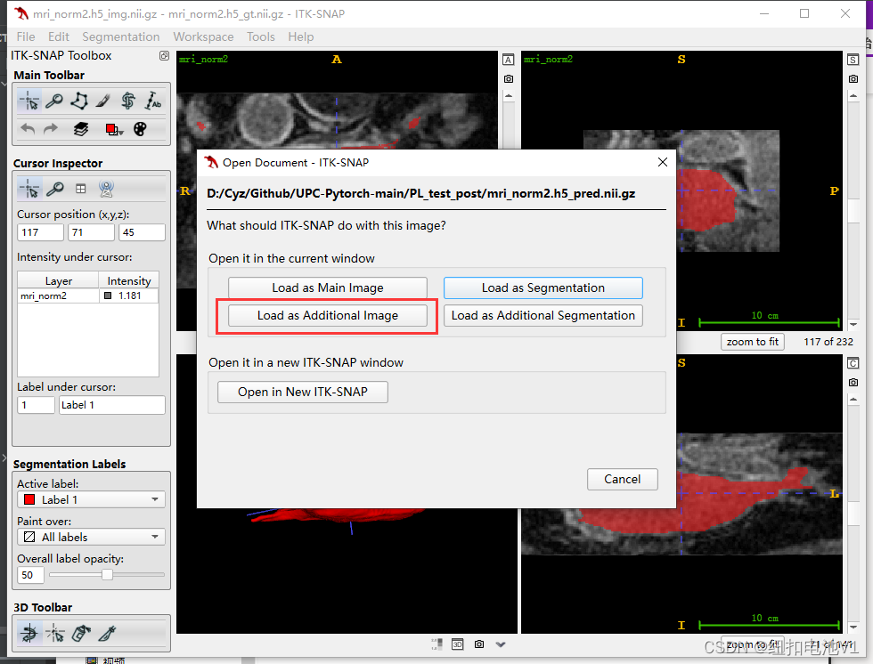 ITKSNAP使用学习_itksnap crosshair-CSDN博客