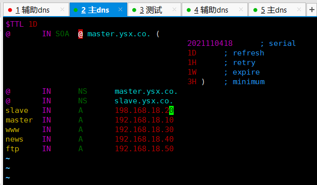 linux centos 8 DNS服务器配置_centos8 dns-CSDN博客