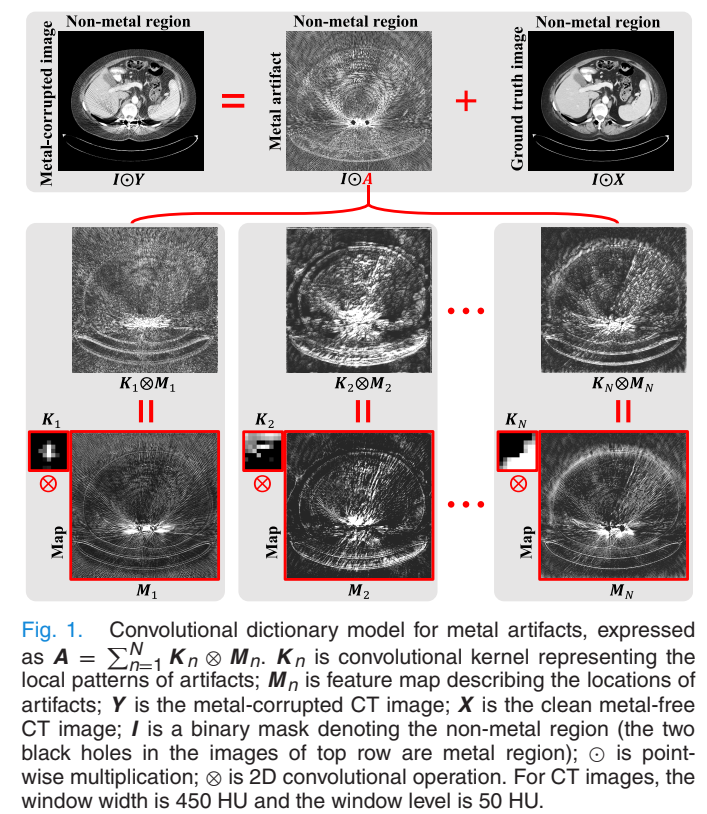 Deep Interpretable Convolutional Dictionary Network for Metal Artifact Reduction in CT Images_卷积 ...