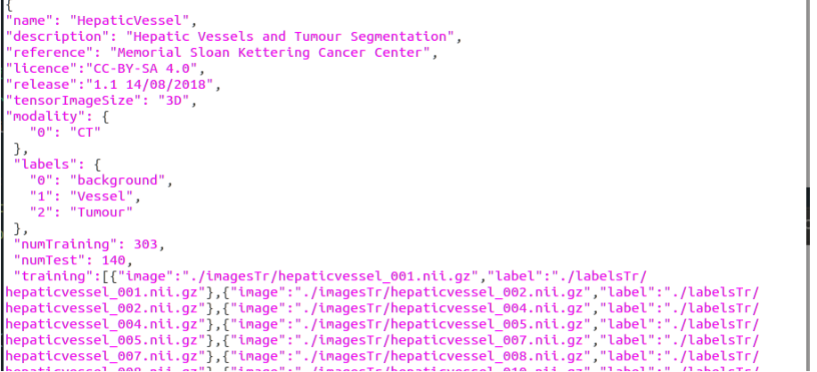 nnUNet一个医学图像分割神仙算法-CSDN博客