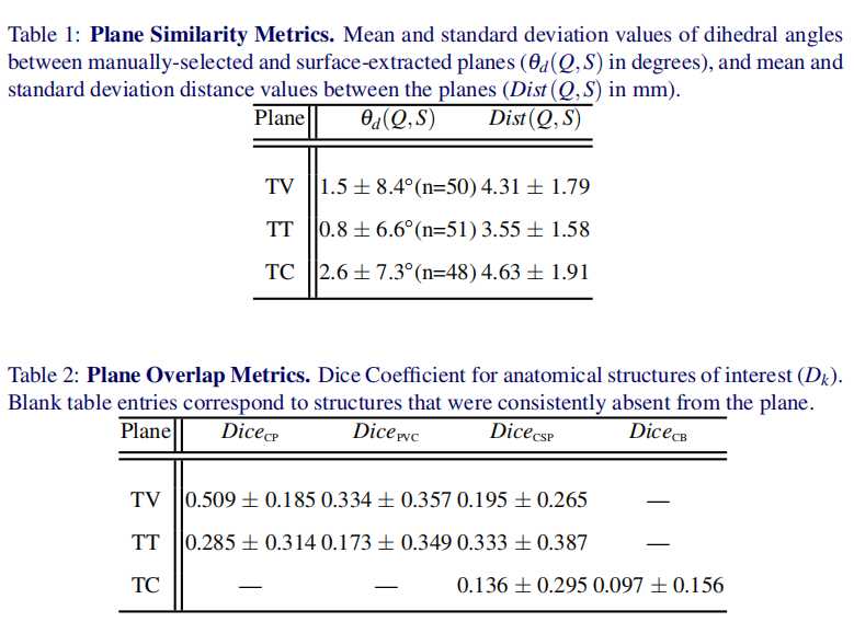 Diagnostic Plane Extraction from 3DParametric Surface of the Fetal Cranium胎儿颅骨三维参数表面的诊断平面提取 ...