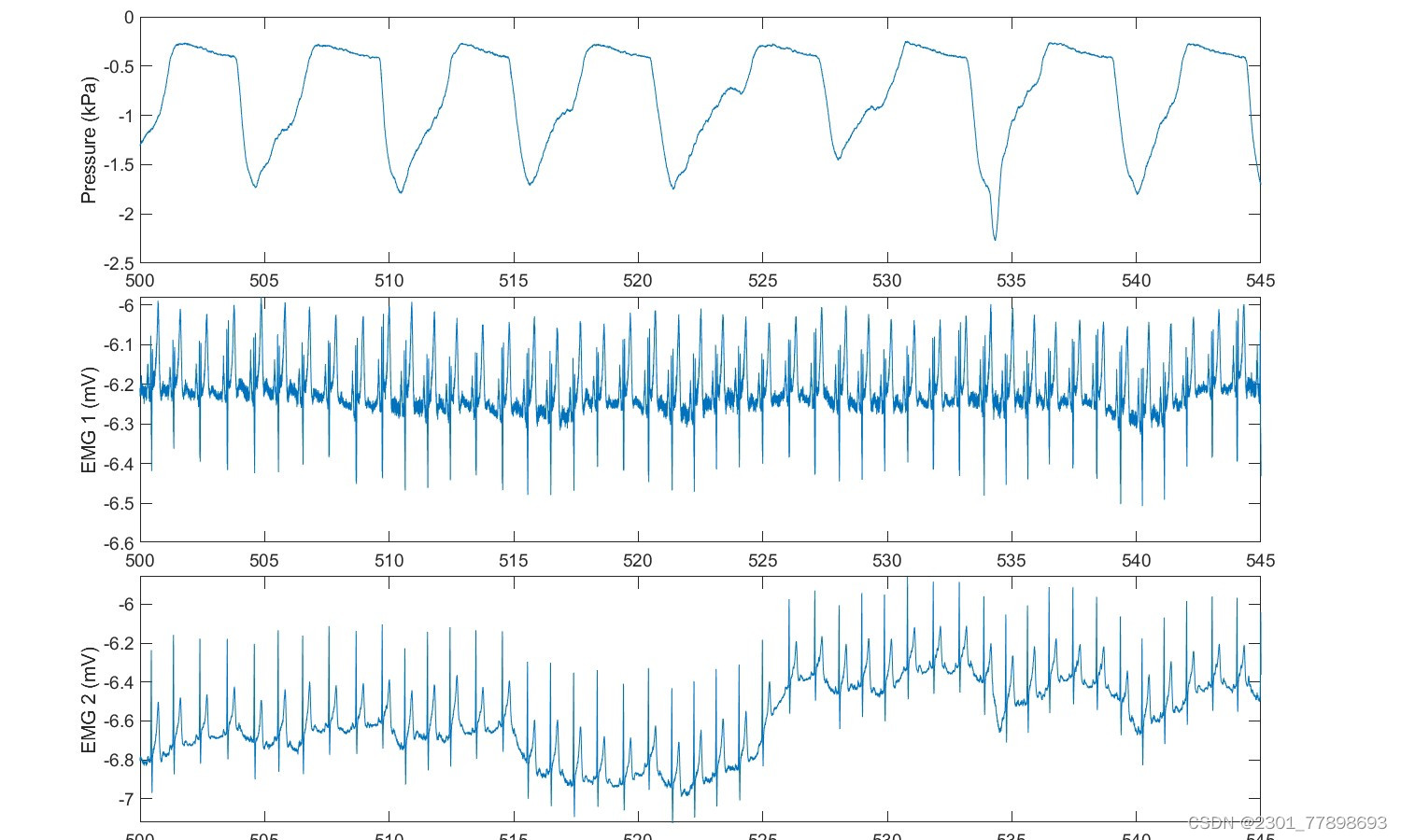 MATLAB环境下EMG信号降噪 执行MATLAB环境下EMG信号降噪_emg噪声-CSDN博客