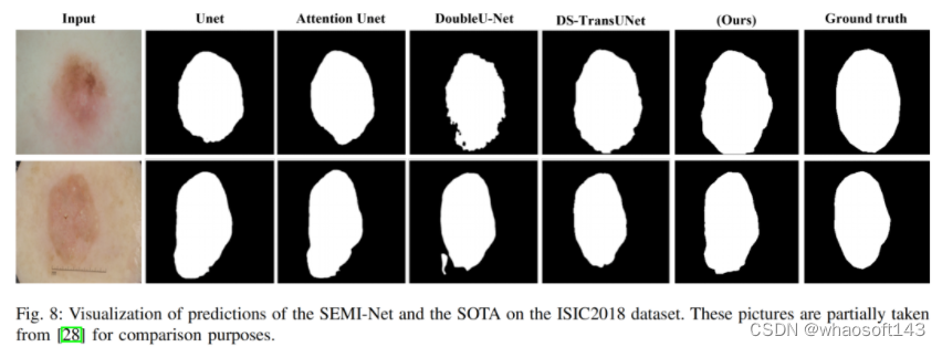 UNet-Transformer_transformer unet-CSDN博客