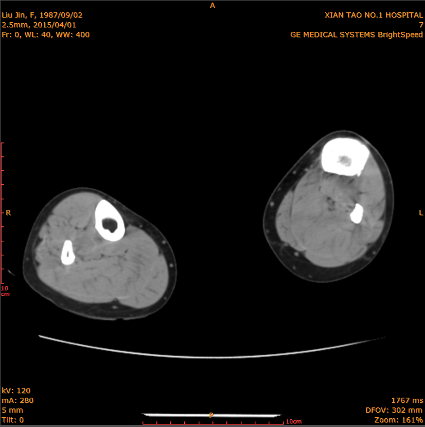 ITK DICOM序列图像读写_imageseriesreader-CSDN博客