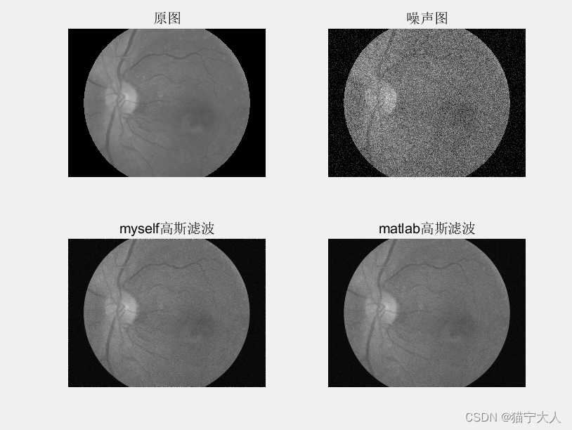 Matlab实现图像滤波 高斯滤波matlab高斯滤波 Csdn博客 