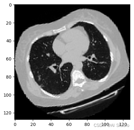 MosMedData: 新冠肺炎胸部 CT扫描数据集上基于3D-CNN实现二分类_3d医学影像二分类网络-CSDN博客