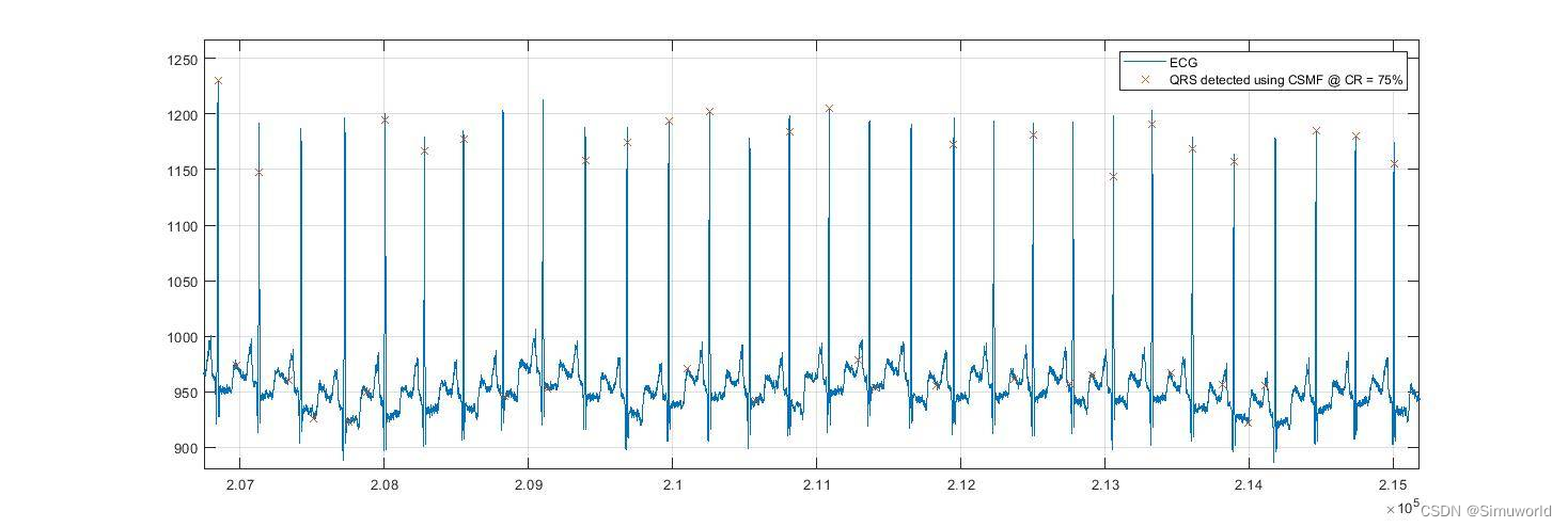 基于压缩感知的心电信号QRS检测算法matlab仿真_心电信号定位 qrs 波位置,形状matlab-CSDN博客