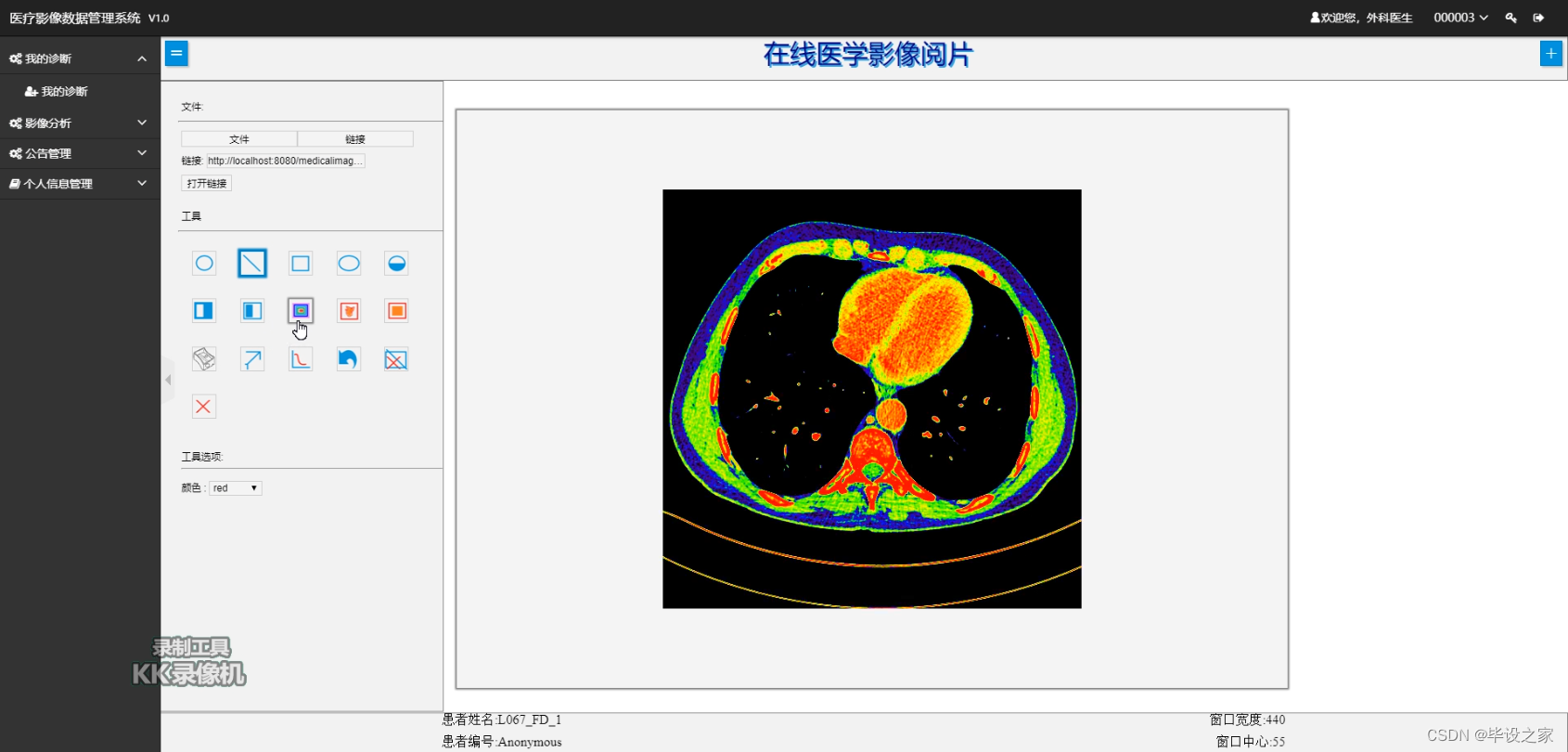 医疗影像数据管理系统的设计与实现论文源码jsp205医疗影视管理系统 Csdn博客