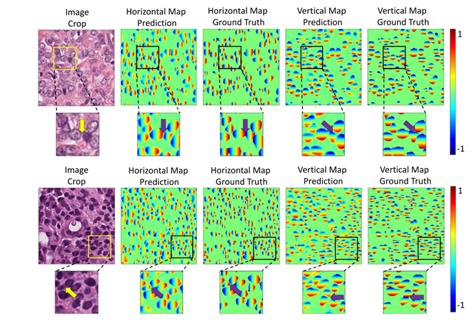 Hover-net: Simultaneous segmentation and classification of nuclei_hovernet-CSDN博客