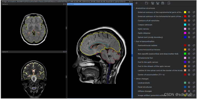 INOBITEC DICOM VIEWER 12.2 Crack_inobitec dicom viewer 2.12 pro crack ...