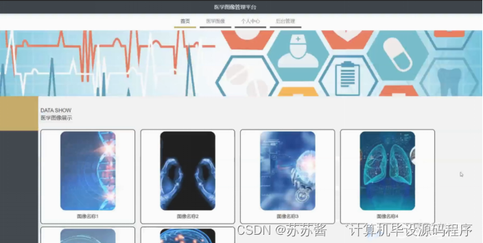 【附源码】java计算机毕业设计医学图像管理平台(程序lw部署)医学图像标注 源码 Csdn博客