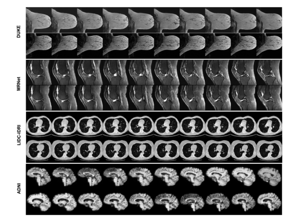 Medical Diffusion - Denoising Diffusion Probabilistic Models for 3D ...