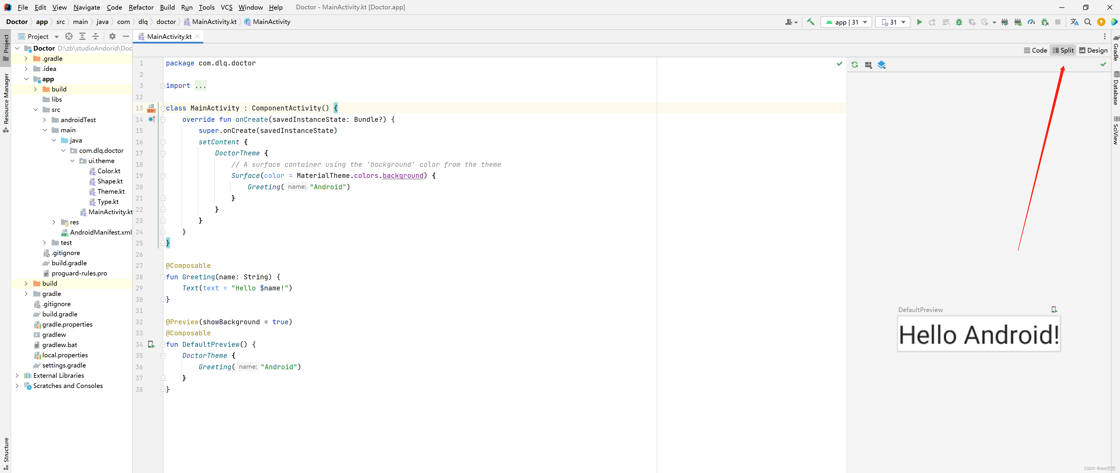 interllj idea开发android compose项目无法预览布局_compose没有预览-CSDN博客
