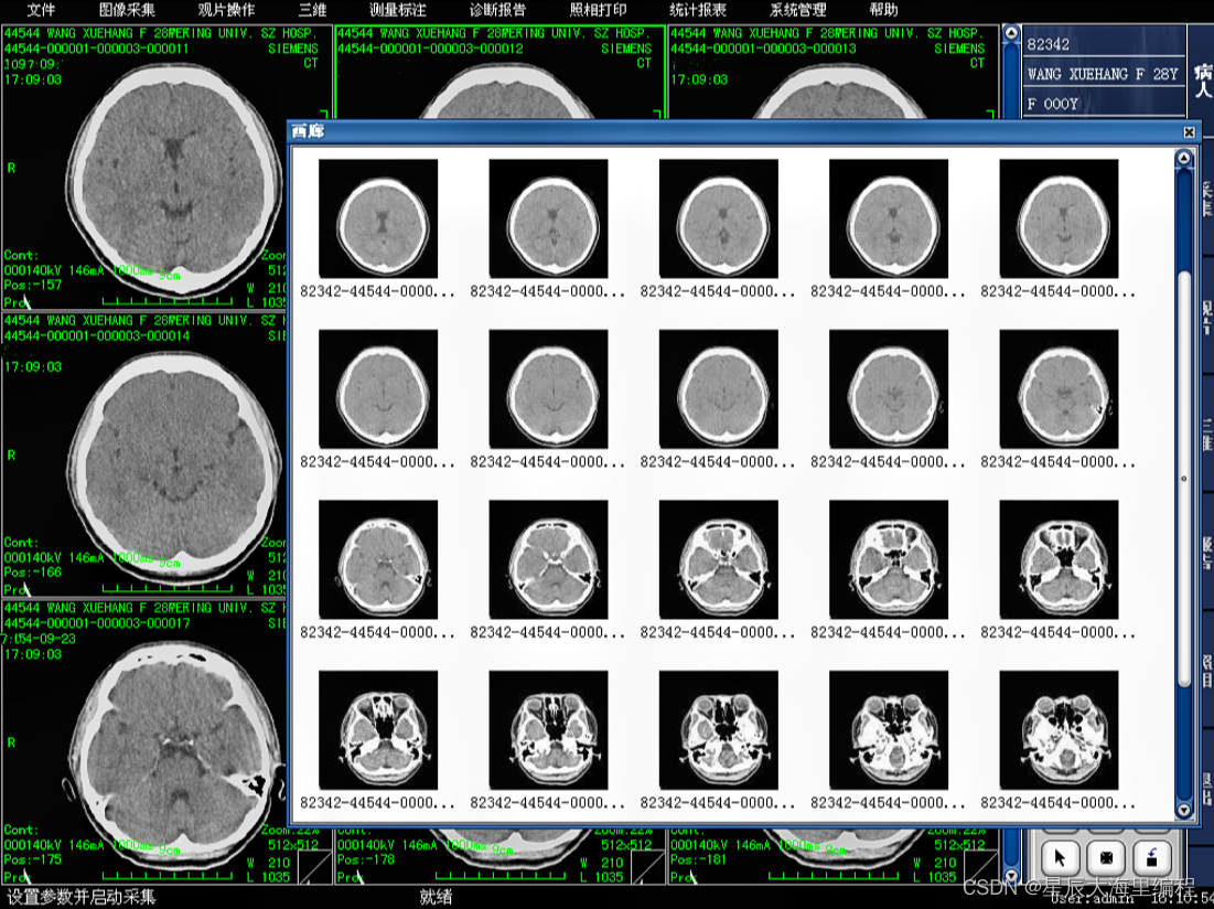 影像科PACS系统：CT断层扫描_pacs ct-CSDN博客