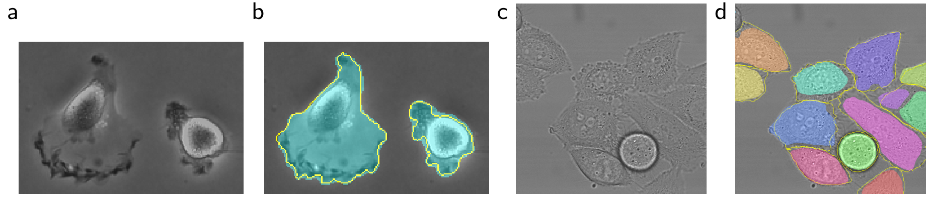 【U-Net2015】U-Net: Convolutional Networks for Biomedical Image ...