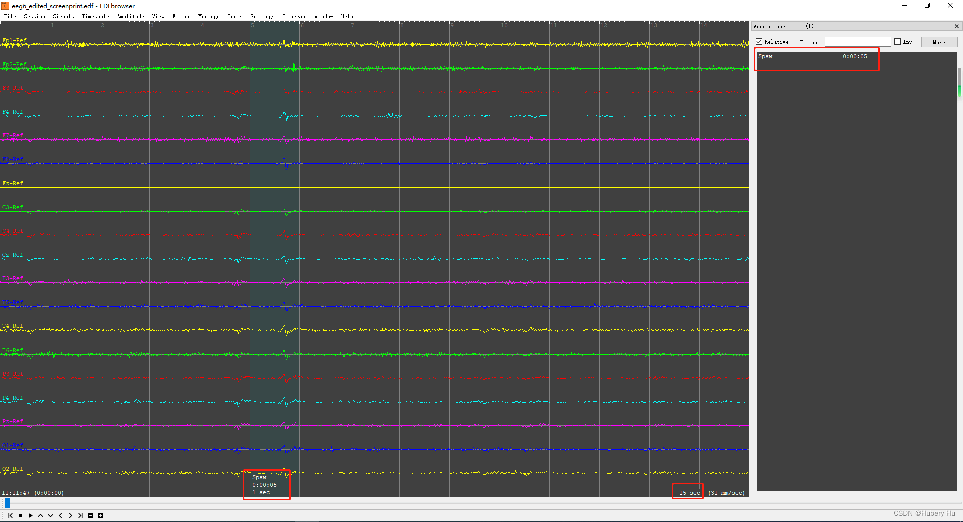 EDF Browser使用说明和技巧_edfbrowser-CSDN博客