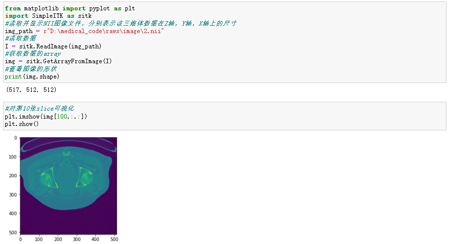 nii数据的各种处理详解_acdc数据集nii文件在pytorch中需要处理吗-CSDN博客