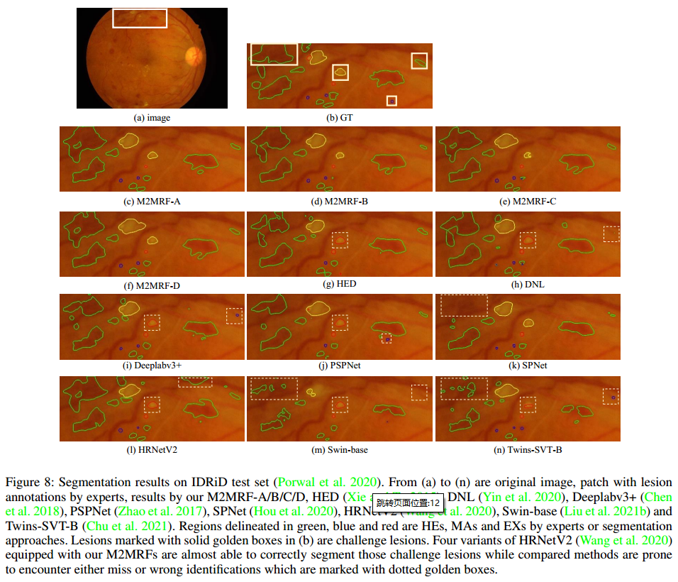 【文献阅读笔记】M2MRF: Many-to-Many Reassembly of Features for Tiny Lesion Segmentation in Fundus Images ...