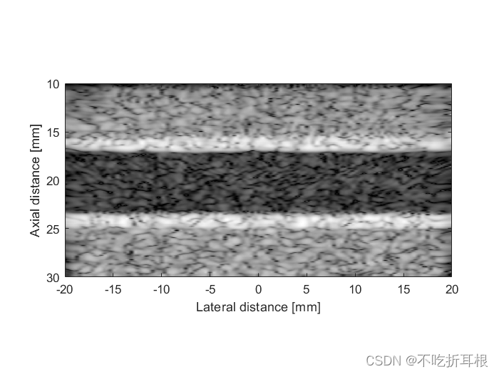 运用Field_II囊肿模型生成静态血管模型--MATLAB_1、建立人体颈总动脉超声仿真模型,并画出三维示意图: 1.1模型几何要求:所在 ...