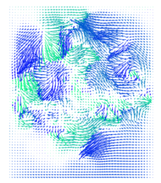 VoxelMorph-无监督医学图像配准-代码讲解-CSDN博客