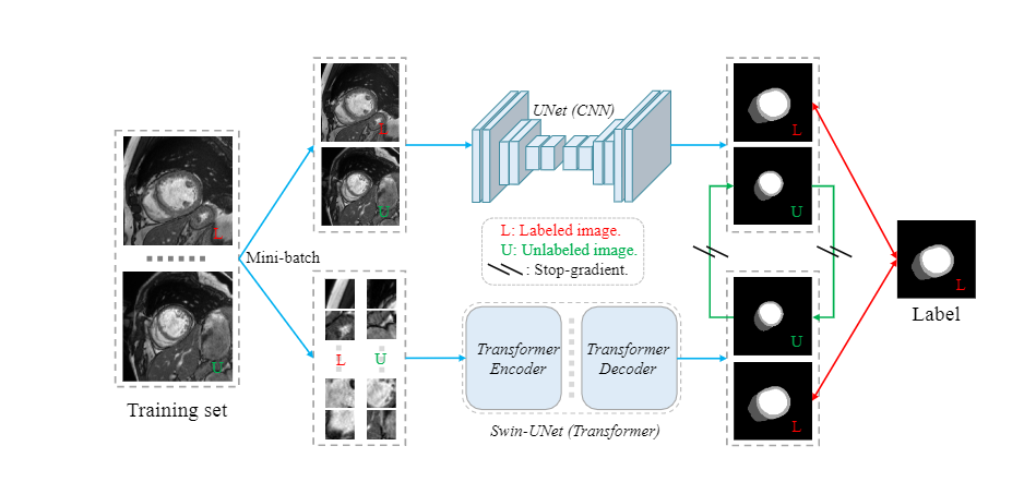 半监督分割与Transformer结合论文阅读（更新中）_semi-supervised medical image segmentation via cro-CSDN博客