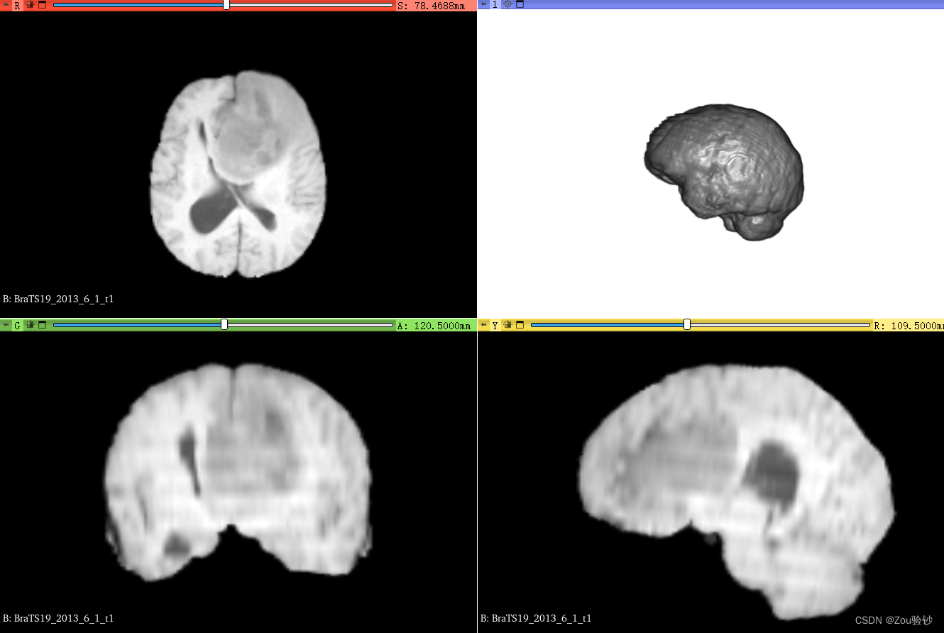 3DSlicer安装及学习_3d slicer读取nii图像-CSDN博客