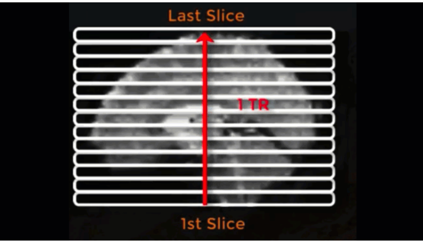 基于spm12对fMRI数据分析_spm12的tpm-CSDN博客