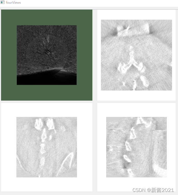 Vtk 医学三维图像四视图显示以及鼠标滑轮控制切片交互vtk 四视图 Csdn博客
