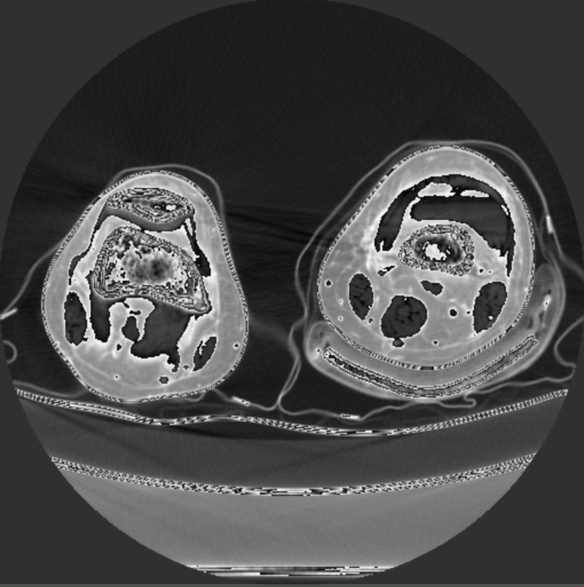 ITK DICOM序列图像读写_imageseriesreader-CSDN博客