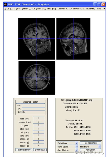 静息态功能磁共振成像(rs-fMRI)原理与数据分析学习笔记（4-5）：The R-fMRI Maps Project and Animal Data_磁共振maps-CSDN博客