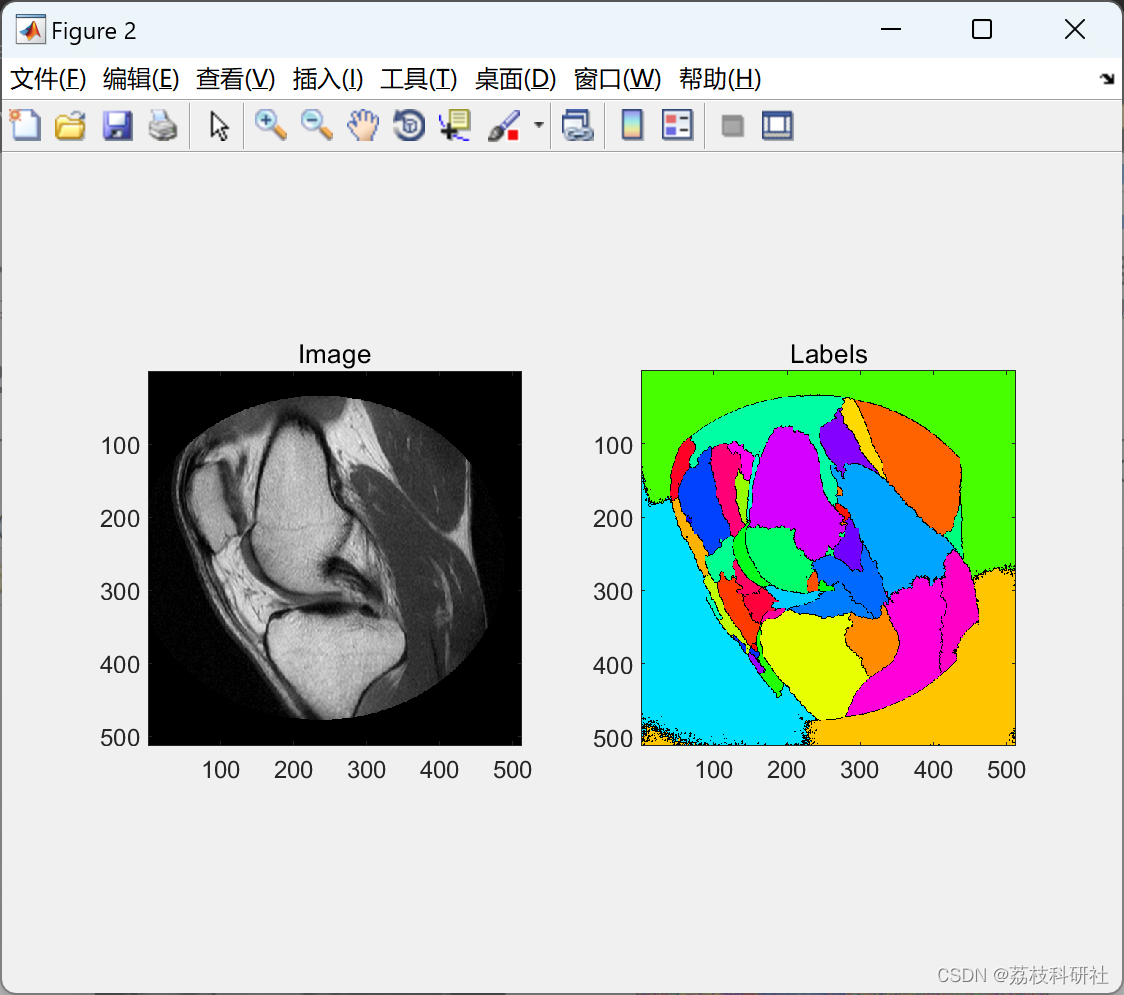 【图像分割】基于局部质心的无监督的2d 和 3d 图像分割（matlab代码实现）三维图像分割 Csdn博客