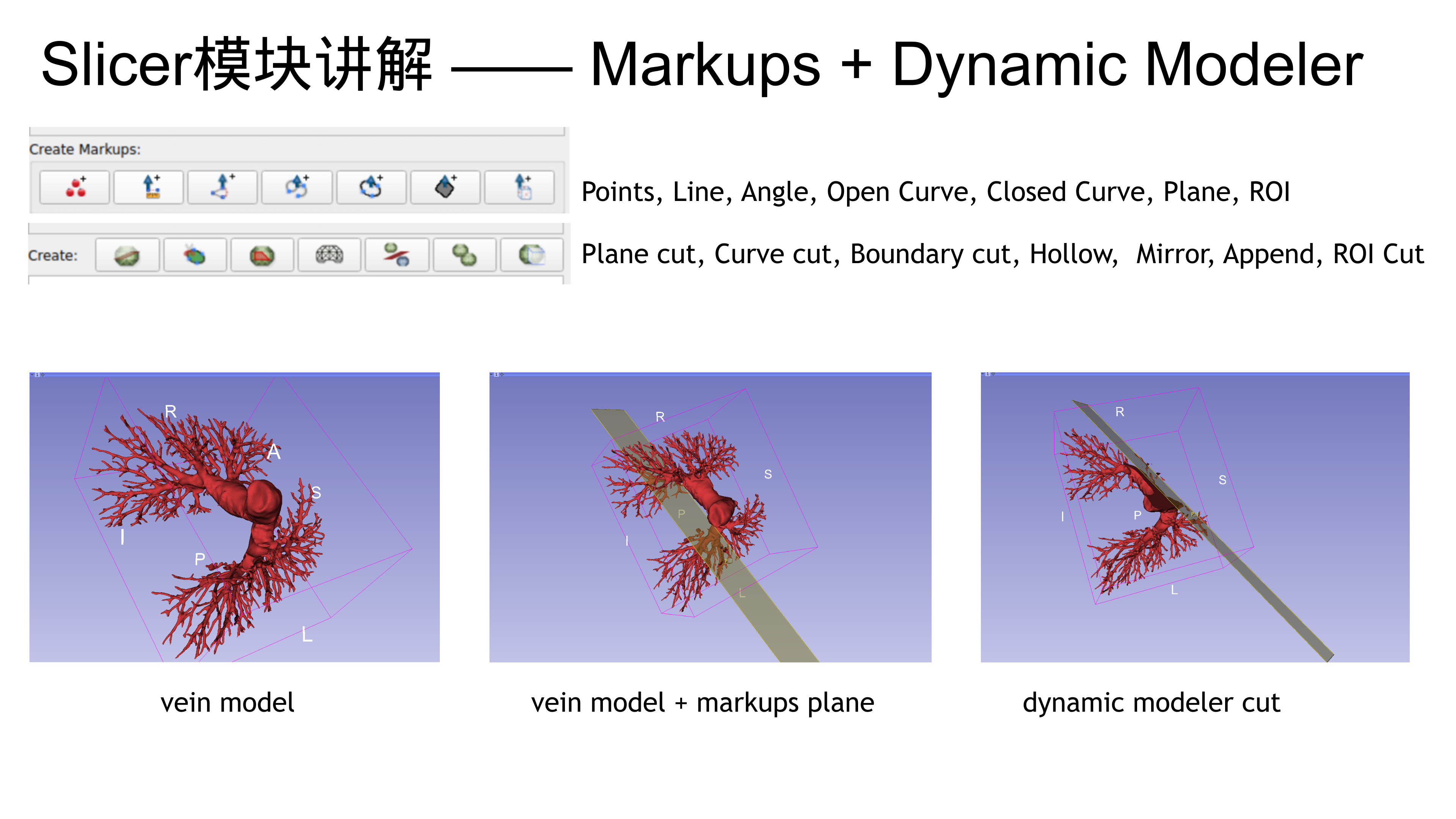 3d Slicer开发者入门_3d slicer 开发者模式-CSDN博客
