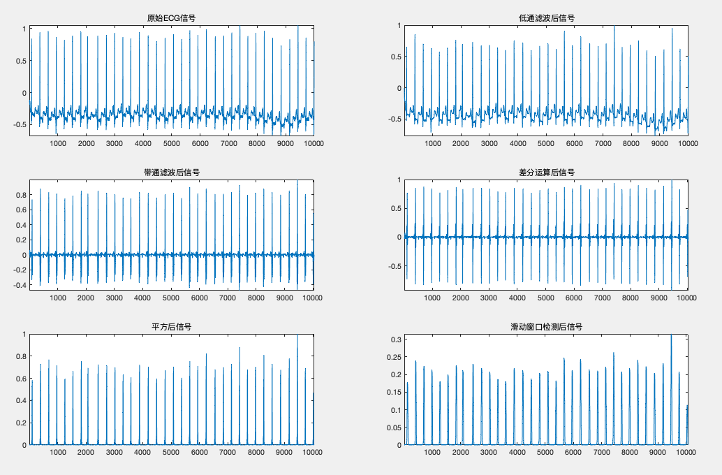 【项目实战-MATLAB】：Pan-Tompkins检测算法-CSDN博客