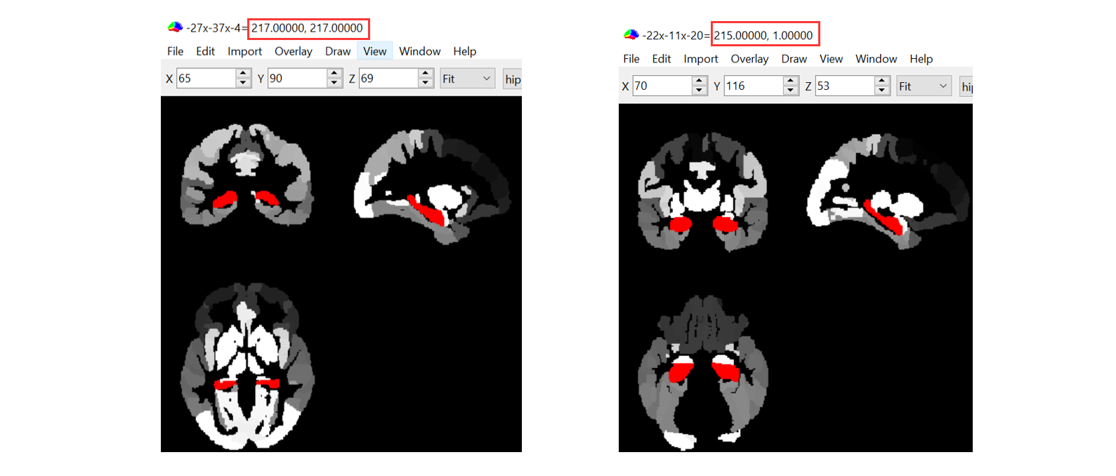 MRI脑影像分析——根据脑图谱获取感兴趣区域mask，以海马体与丘脑为例(matlab+nilearn+nibabel+REST1.8）_rest 相关性脑区-CSDN博客