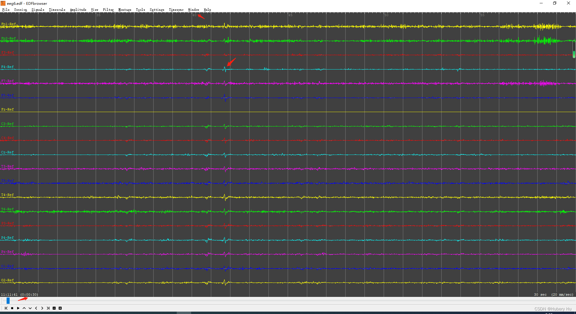 EDF Browser使用说明和技巧_edfbrowser-CSDN博客