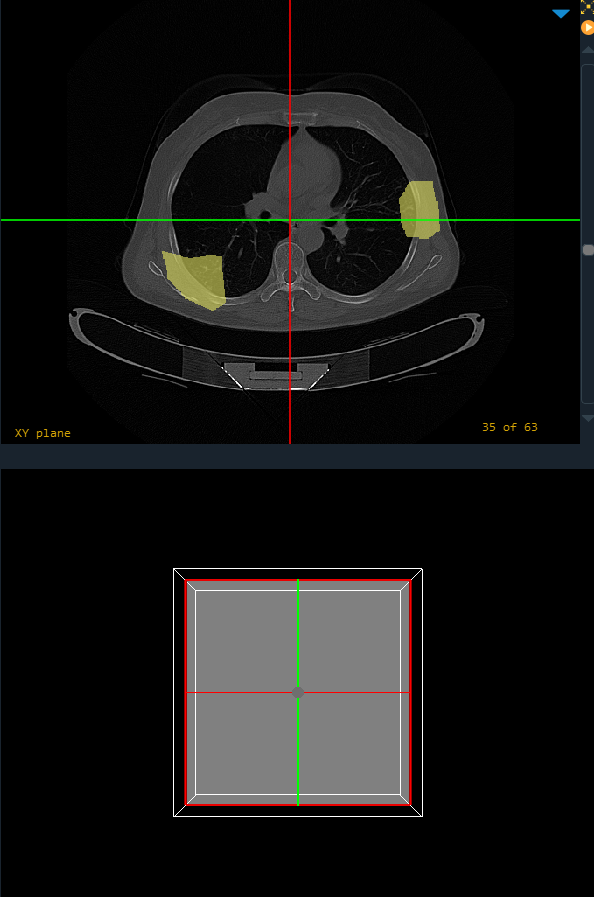 【Pair使用笔记指南2】导入已经标注好的标签到 pair 软件二次标注_用什么软件标注可以保存成nii.gz格式-CSDN博客