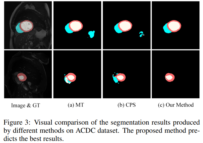 【IJCAI2022】Uncertainty-Guided Pixel Contrastive Learning for Semi-Supervised Medical Image ...