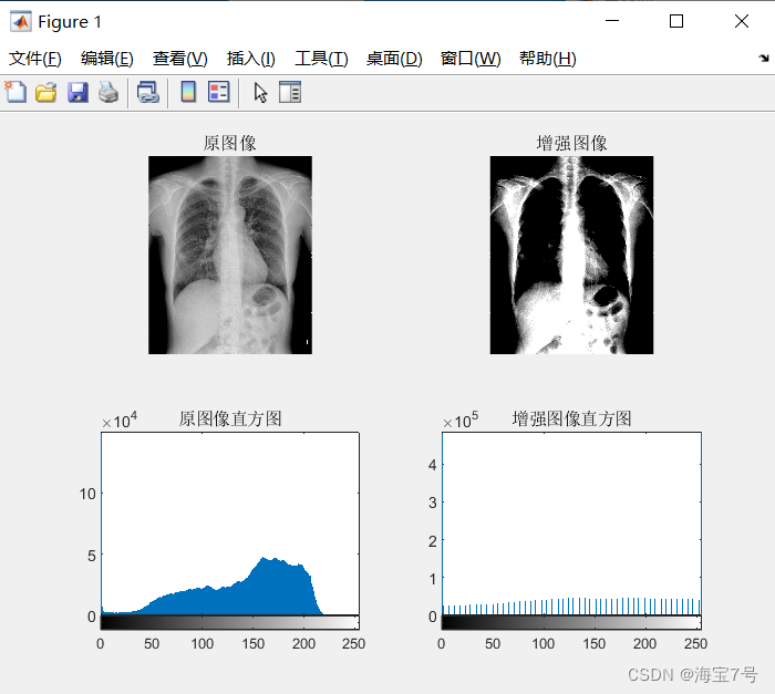 【第 26 章 基于最小误差法和区域生长的医学影响分割系统 Matlab深度学习实战gui项目】基于matlab Gui的医用系统开发 Csdn博客
