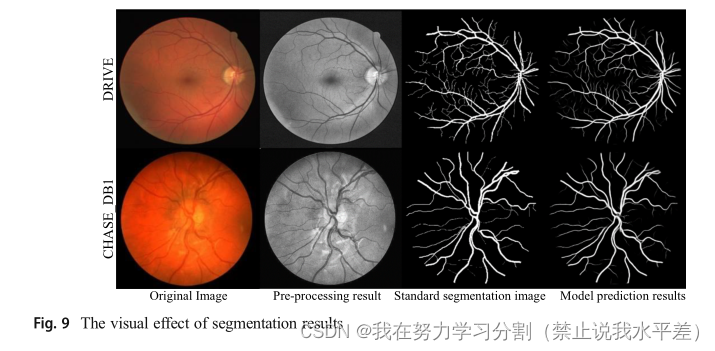 Dcu Net:a Deformable Convolutional Neural Networkbased On Cascade U Net