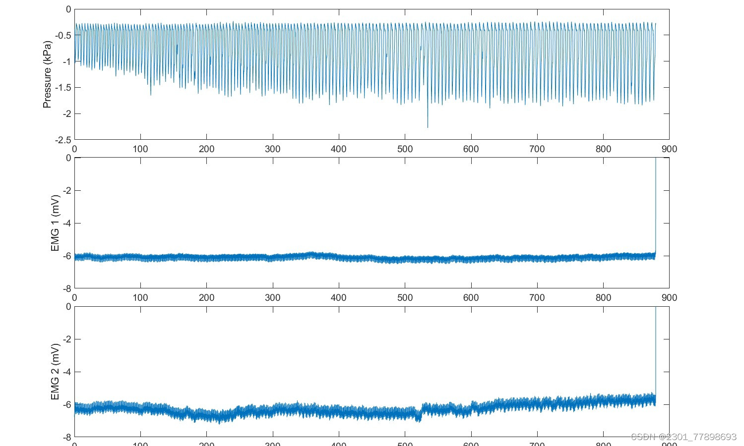 MATLAB环境下EMG信号降噪 执行MATLAB环境下EMG信号降噪_emg噪声-CSDN博客