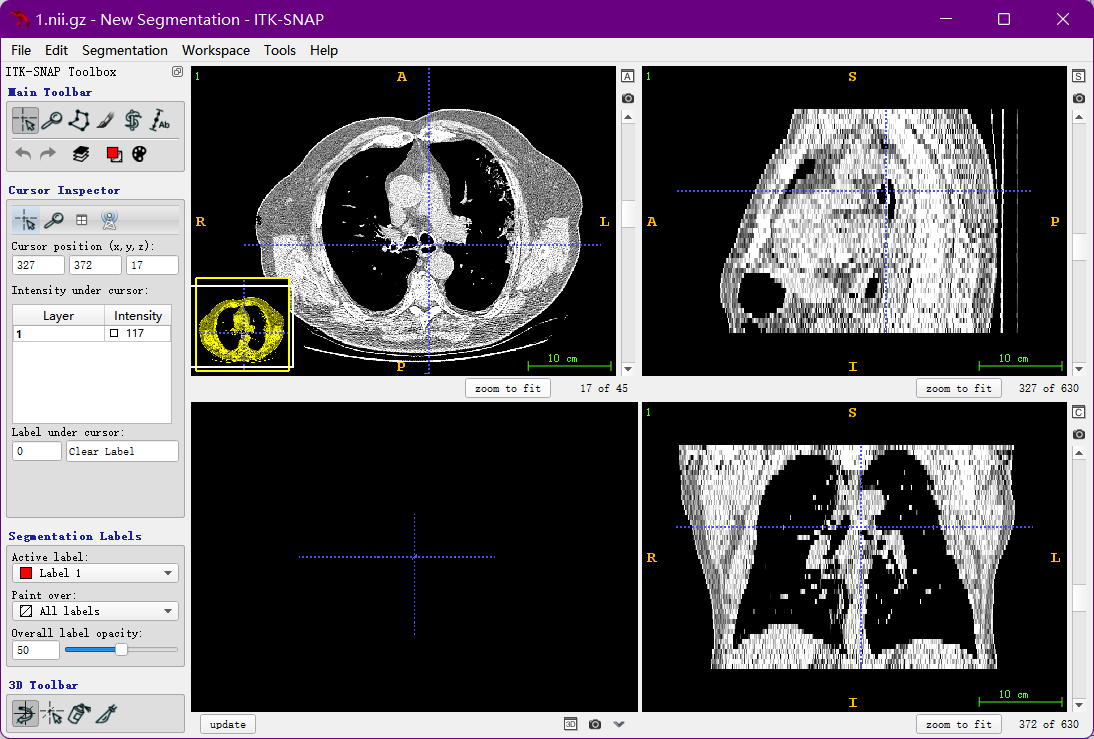 ITK-Snap 处理医疗影像-CSDN博客