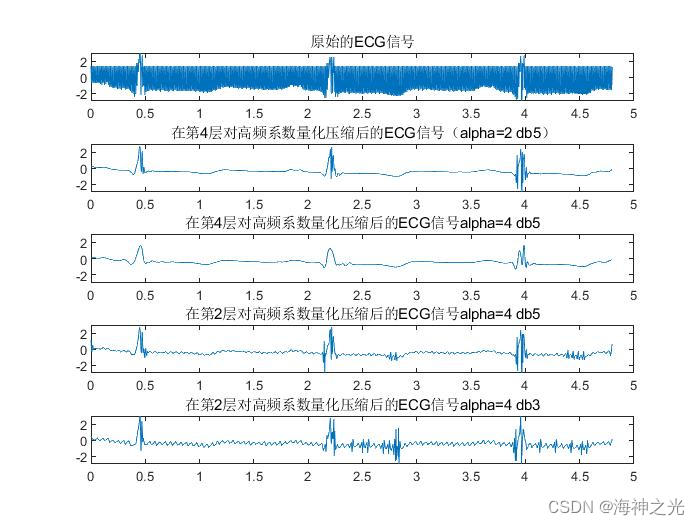 【心电信号ECG去噪】基于matlab小波变换（heursure规则阈值+Minimax规则阈值）心电信号去噪【含Matlab源码 3402期】_基于matlab实现ecg心电信号处理-CSDN博客