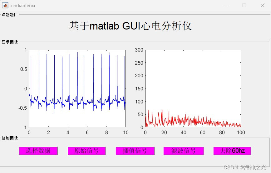 【心电信号】基于matlab GUI心电信号分析【含Matlab源码 2627期】_matlab gui 信号分析-CSDN博客