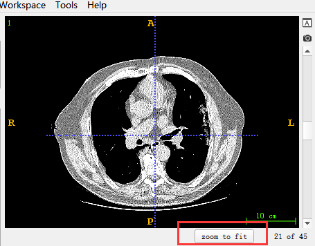 ITK-Snap 处理医疗影像-CSDN博客