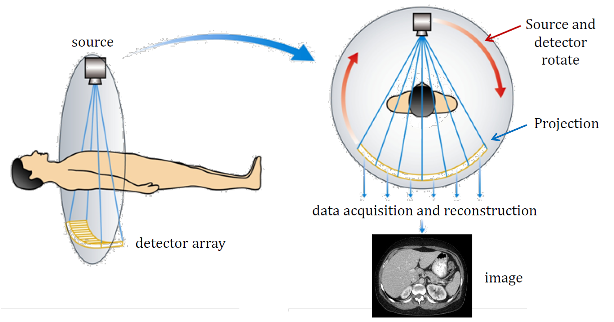 Radon变换与Matlab代码_radon变换 正弦图-CSDN博客