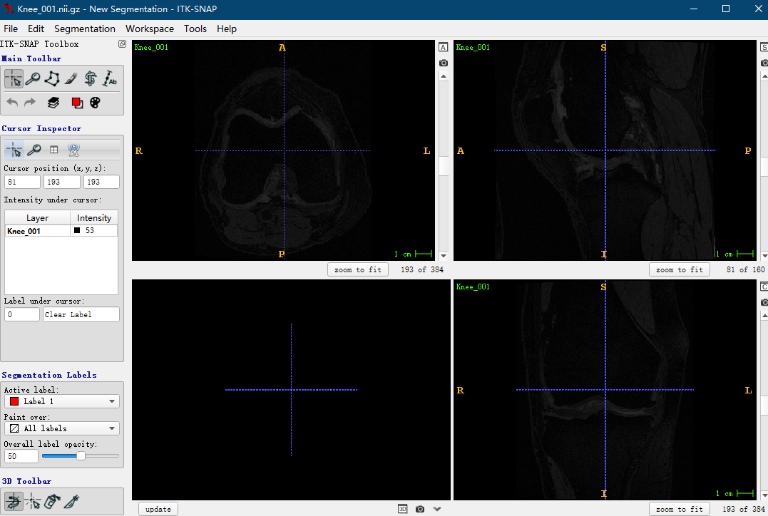 3d医学图像nii.gz转换为png(单次处理单视窗）_nii.gz格式的数据把3d转为2维png图片-CSDN博客