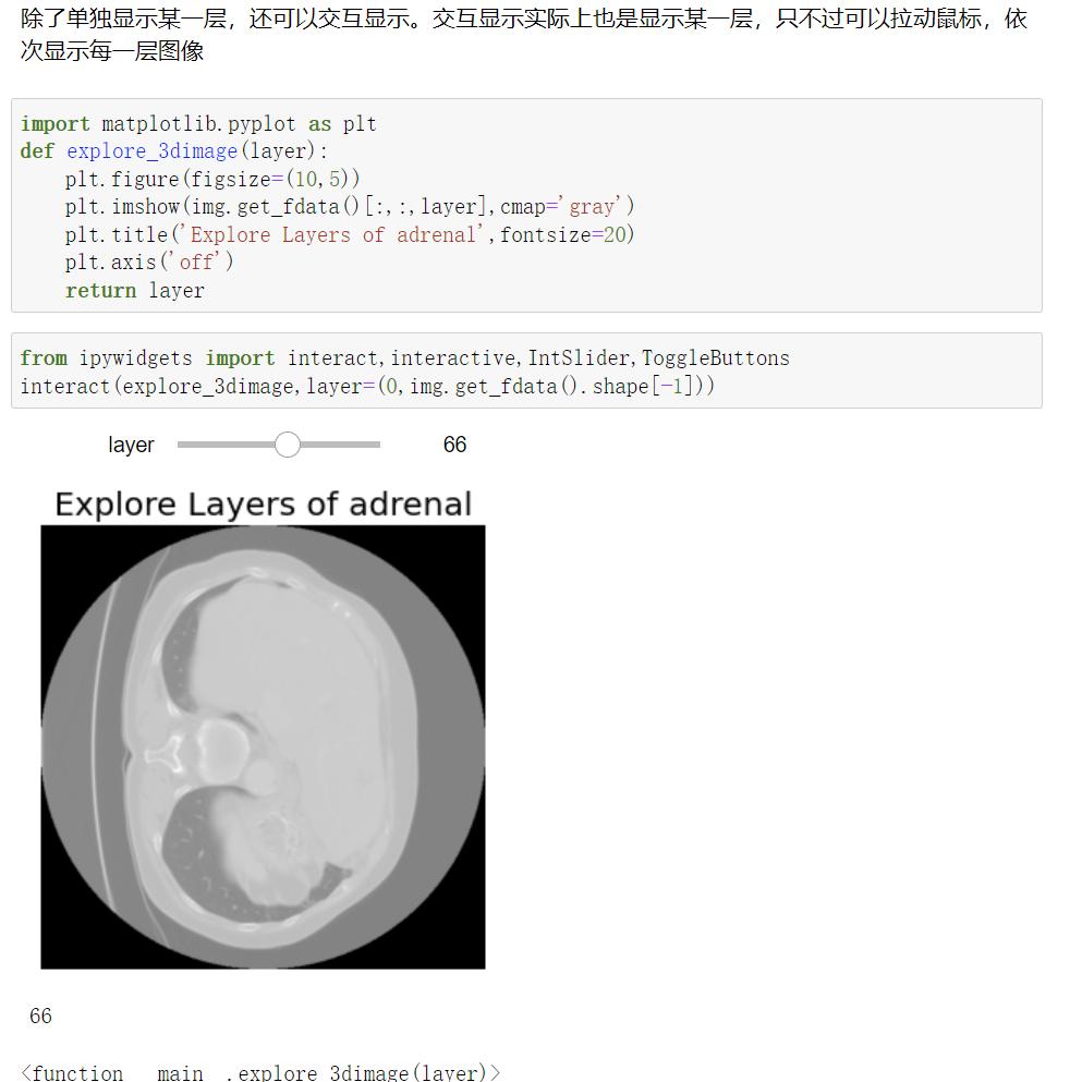 nii数据的各种处理详解_acdc数据集nii文件在pytorch中需要处理吗-CSDN博客
